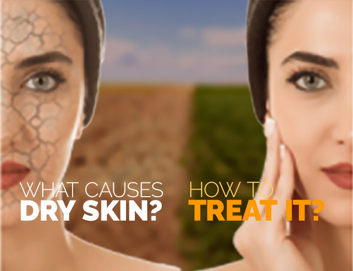 What Causes Dry Skin & How to Treat It Like a Skincare Expert